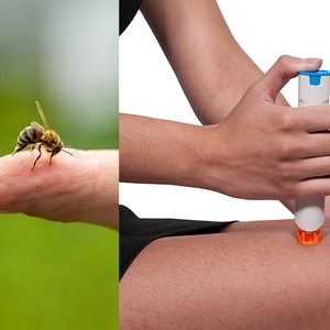 Understanding Anaphylaxis